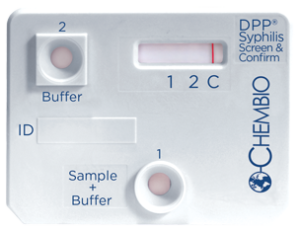 DPP® Syphilis Screen & Confirm Europe – Chembio Diagnostics, Inc.