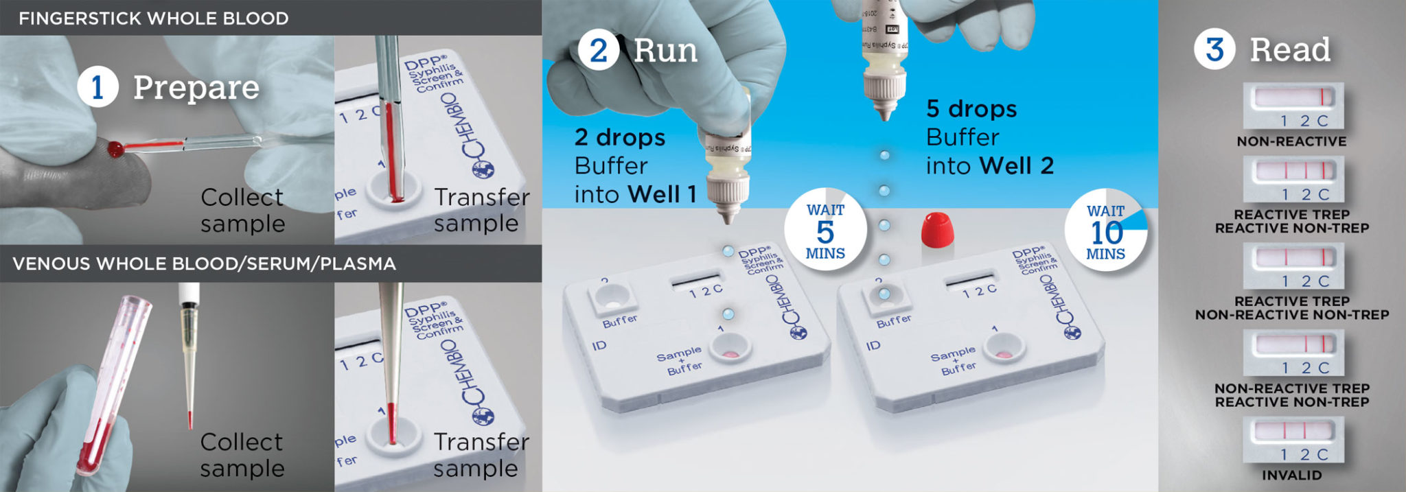 DPP® Syphilis Screen & Confirm Europe – Chembio Diagnostics, Inc.