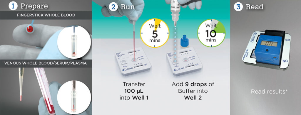 DPP® ZCD IgM/IgG System Europe - Chembio Diagnostics, Inc.
